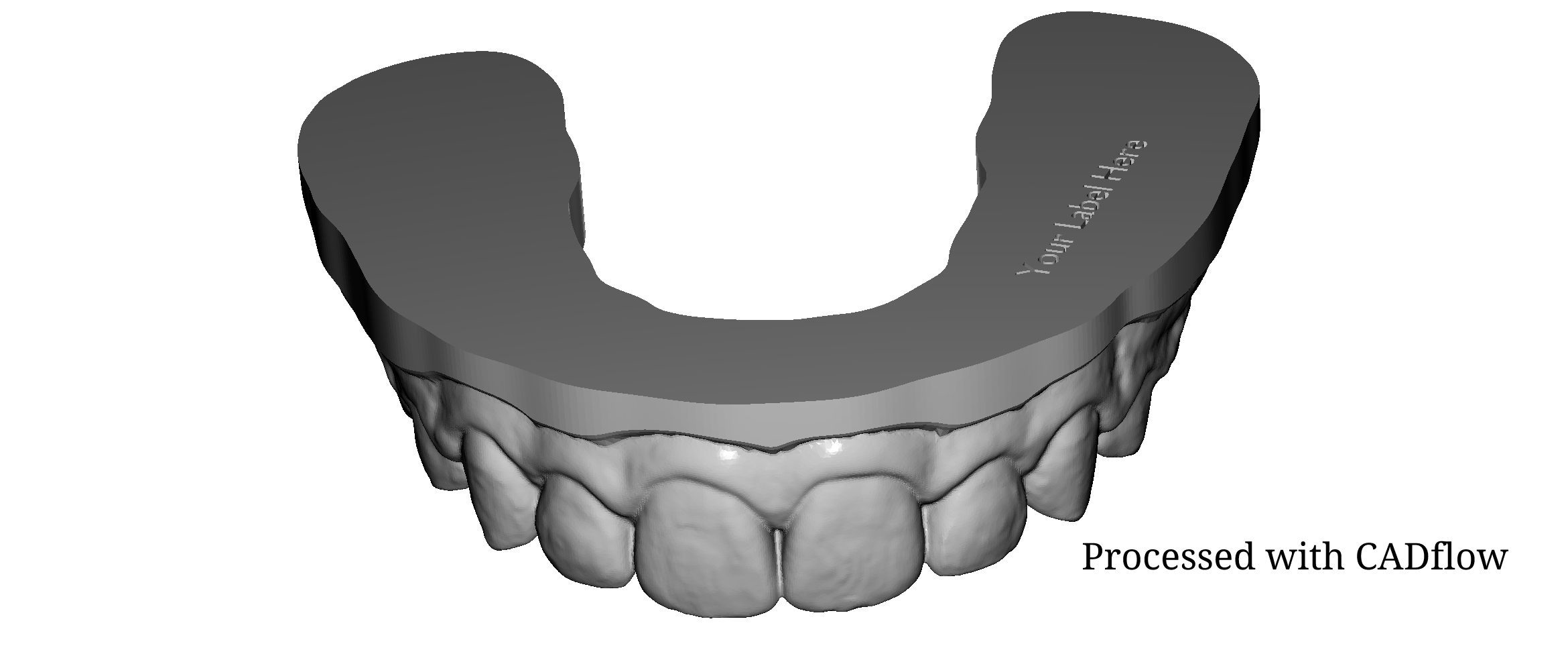 CADflow : Automated Digital Dentistry Solution for Labs and Practices